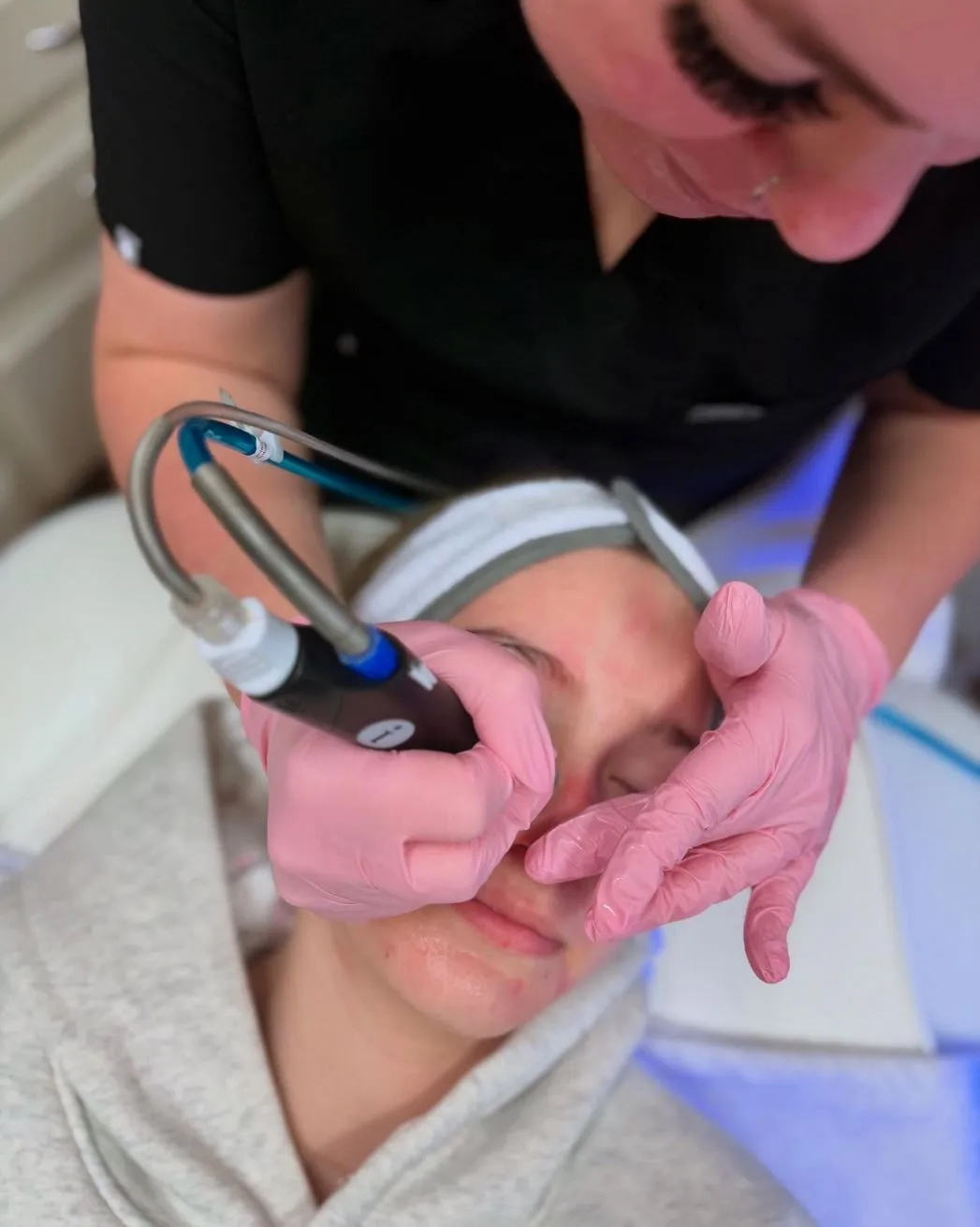 Are HydraFacials Really Worth It?